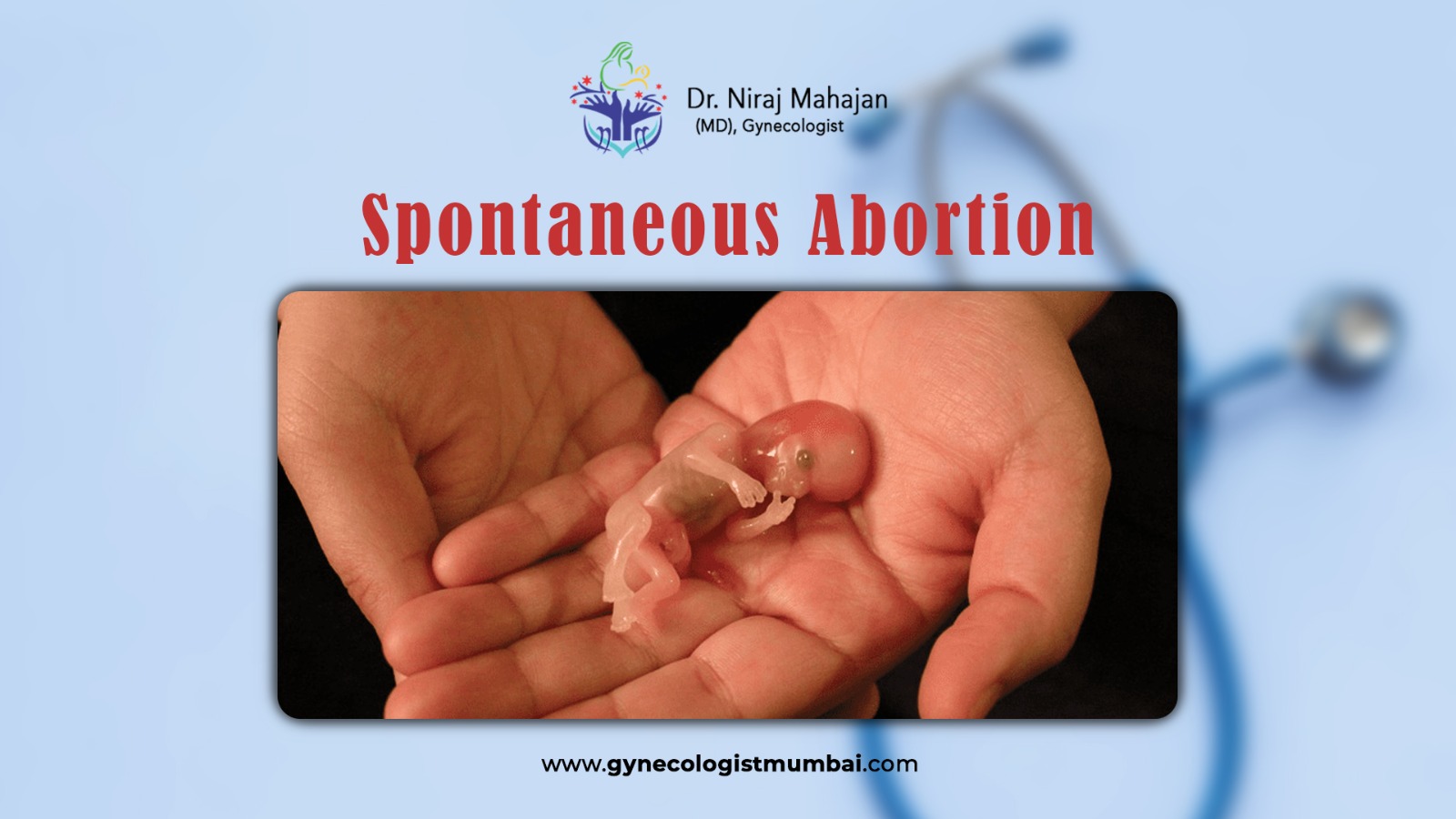 Spontaneous Abortion FAQs: Detailed Information and Guidance